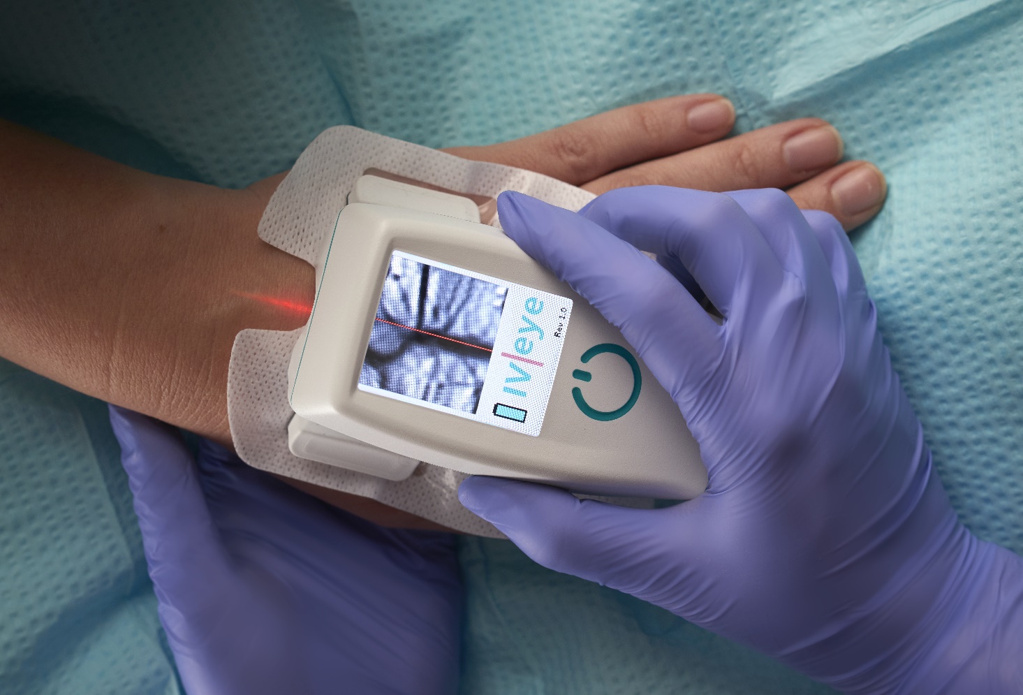 Vascular Access - IV-eye portable near infrared vein imager | CorVascular
